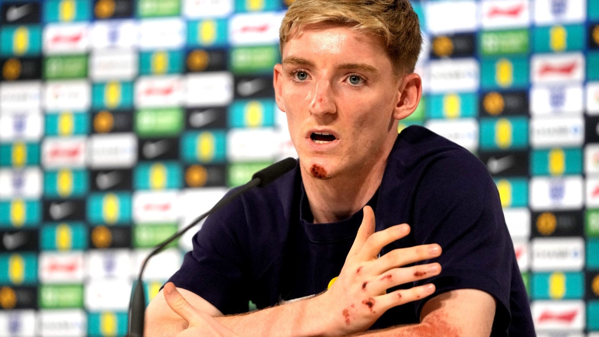 Derfor ser han slik ut