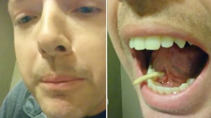 Brandon kjente noe ubehagelig under tunga – så åpnet han munnen